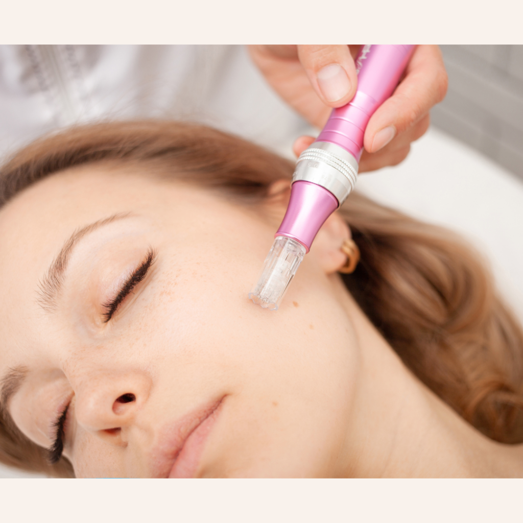 The Difference Between Microneedling and Microdermabrasion