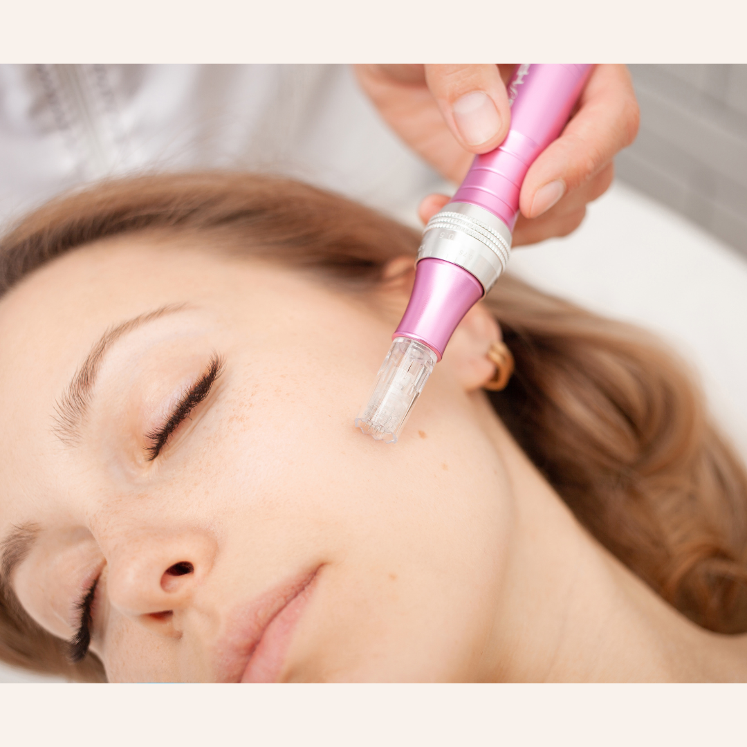 The Difference Between Microneedling and Microdermabrasion